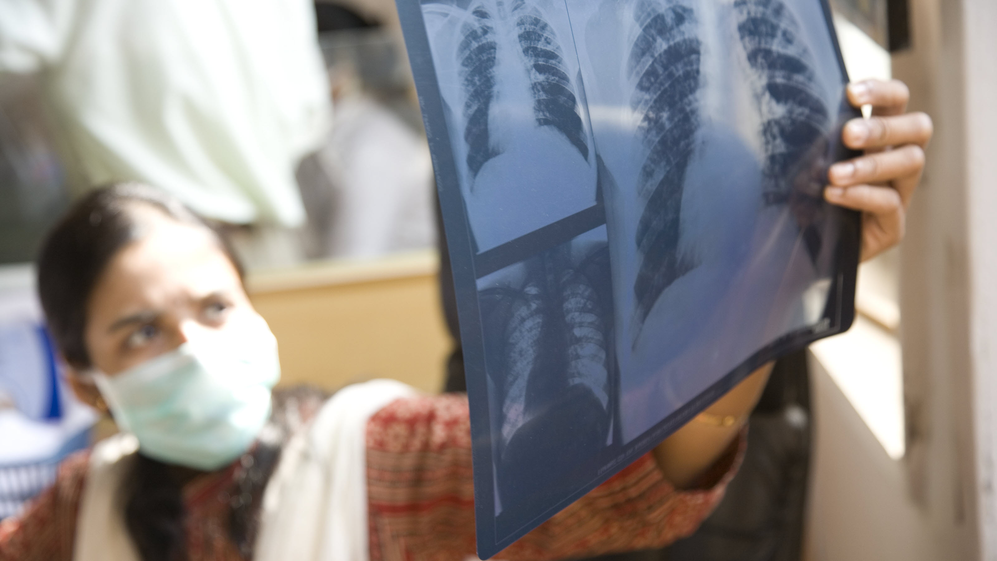 Tuberculosis - Eradication & Prevention