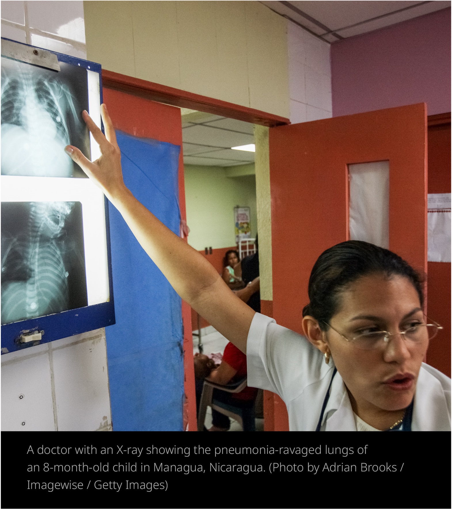 Creating a Life-Saving PCV Vaccine for Pneumonia in India