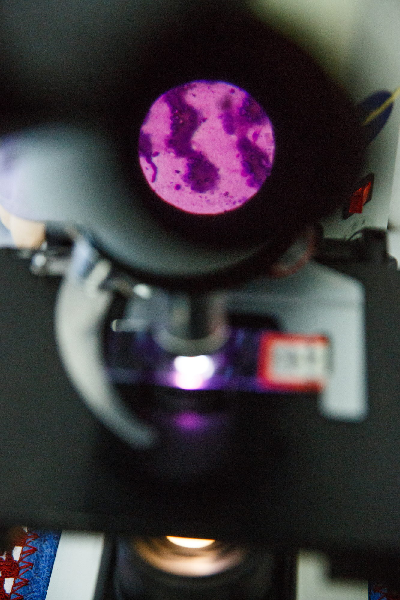 Combating NTDs: What we can learn from the success of eliminating ...