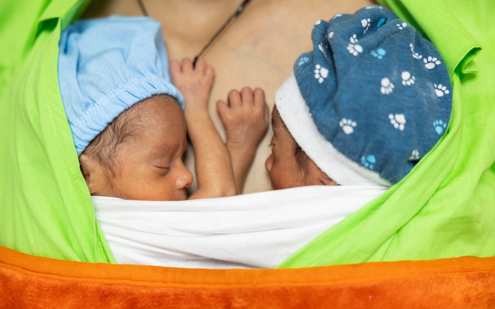 Immediate kangaroo mother care is keeping more preterm babies alive