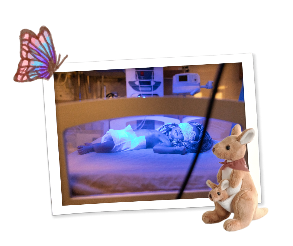 Immediate kangaroo mother care is keeping more preterm babies alive